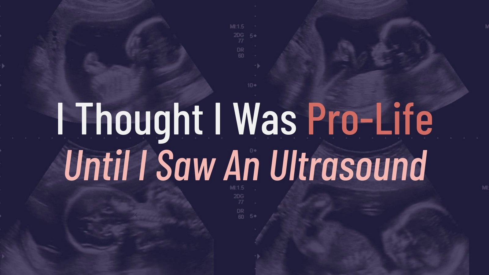 I Thought I Was Pro-Life Until I Saw an Ultrasound – SaveCashClub